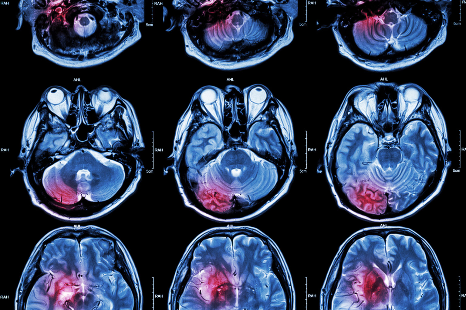 Brain Imaging after an Injury - Elizabeth Sandel, M.D.